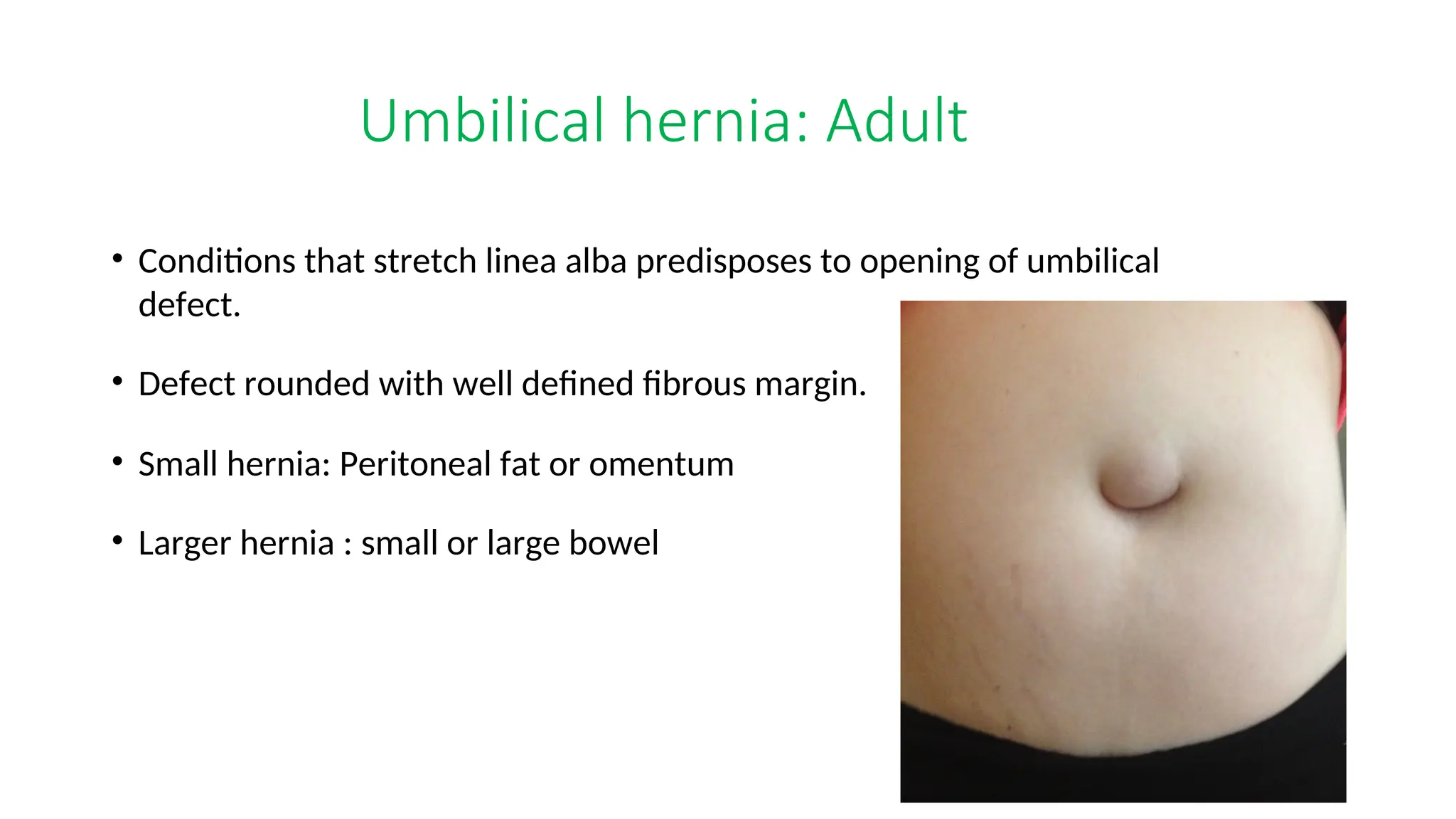 Hernia En Glissade - Auto News